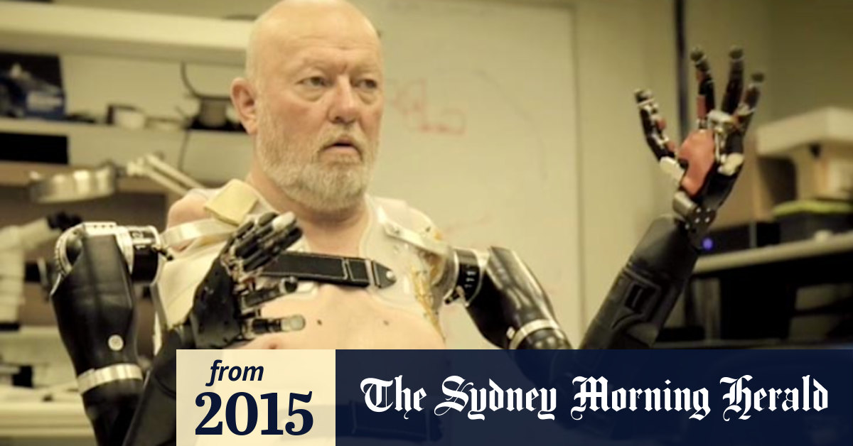 Video: Prosthetic Limbs, Controlled by Thought Video: Prosthetic Limbs, Controlled by Thought